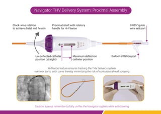 Get to Know about the MITSU™ POLYGLACTIN 910 Synthetic Absorbable ...