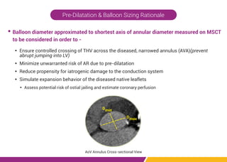 Get to Know about the MITSU™ POLYGLACTIN 910 Synthetic Absorbable ...