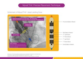Get to Know about the MITSU™ POLYGLACTIN 910 Synthetic Absorbable ...