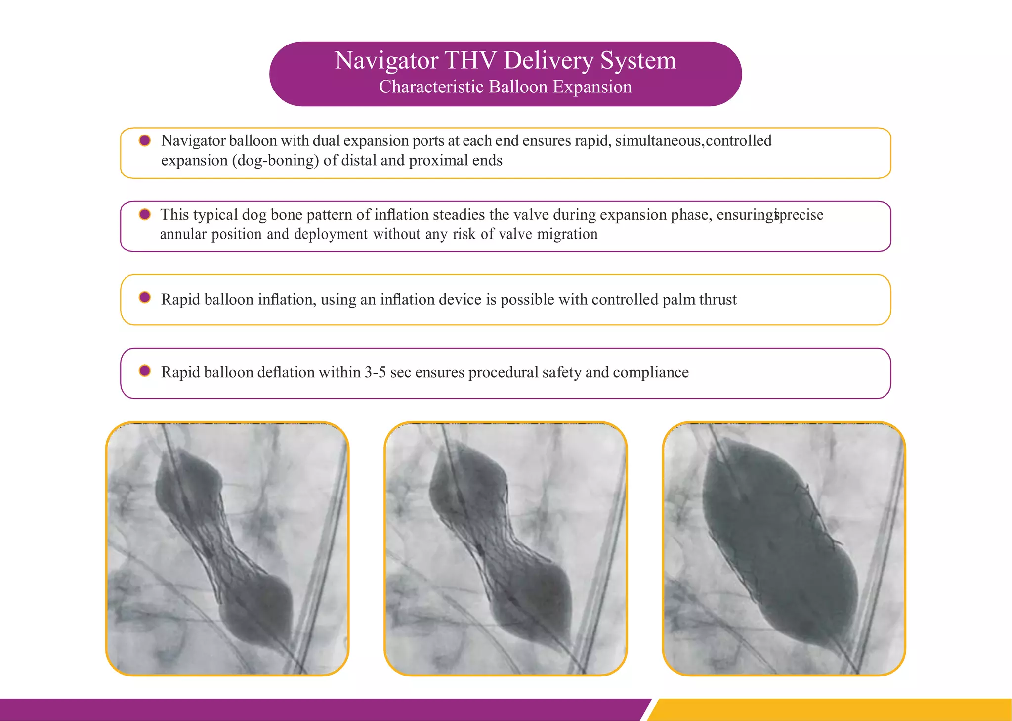 Myval THV Transcatheter Heart Valve by Meril Life | PDF