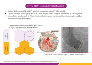 Myval THV Transcatheter Heart Valve by Meril Life | PDF