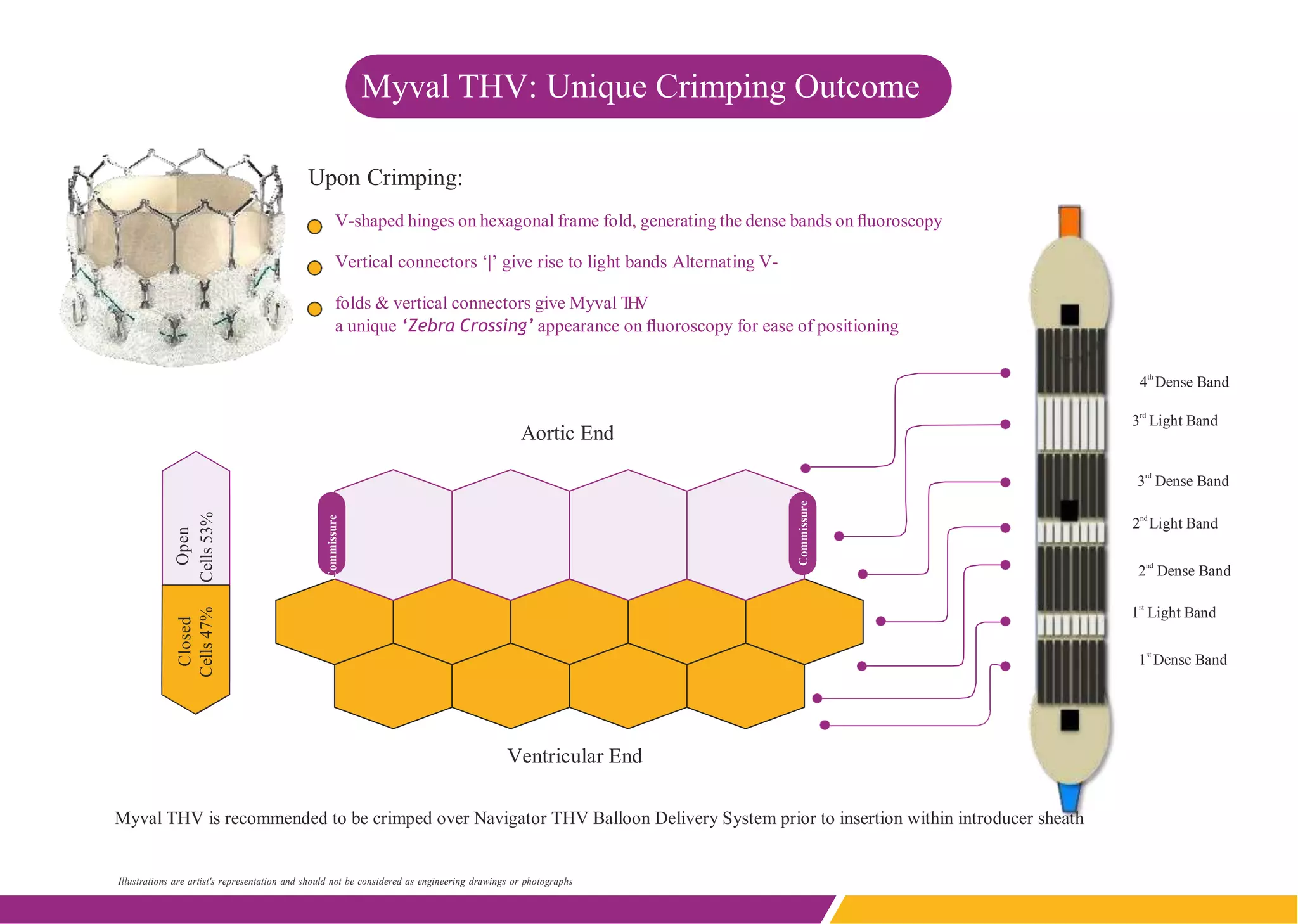 Myval THV Transcatheter Heart Valve by Meril Life | PDF
