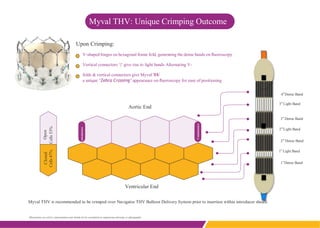 Myval THV Transcatheter Heart Valve by Meril Life | PDF