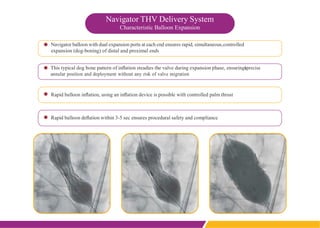 Myval THV Transcatheter Heart Valve by Meril Life.pdf