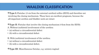 Classification of vesicovaginal fistulas | PPT