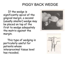 wedges | PPTX
