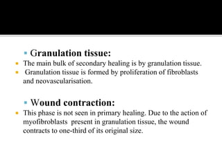 WOUND HEALING AND ENDODONTICS | PPTX