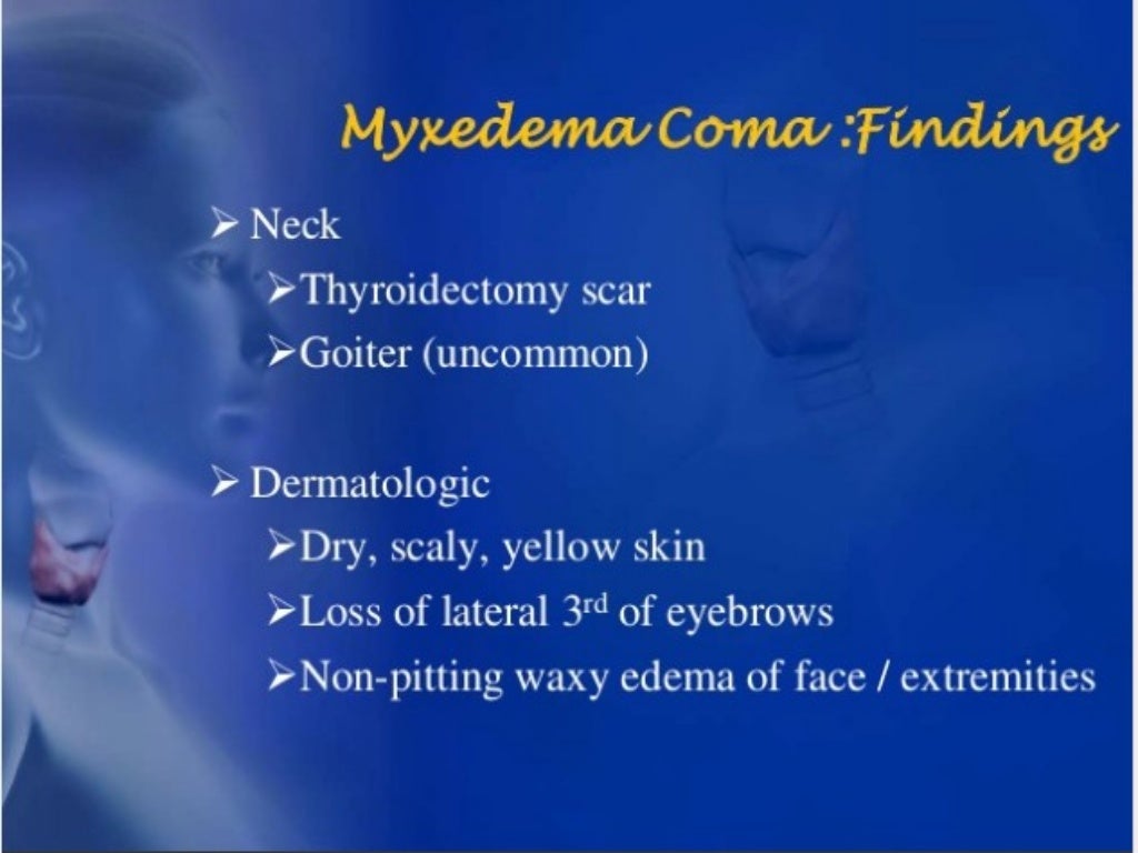 Myxedema: Coma, Symptomer, Biller, Behandlungen A Méi – LEKPU