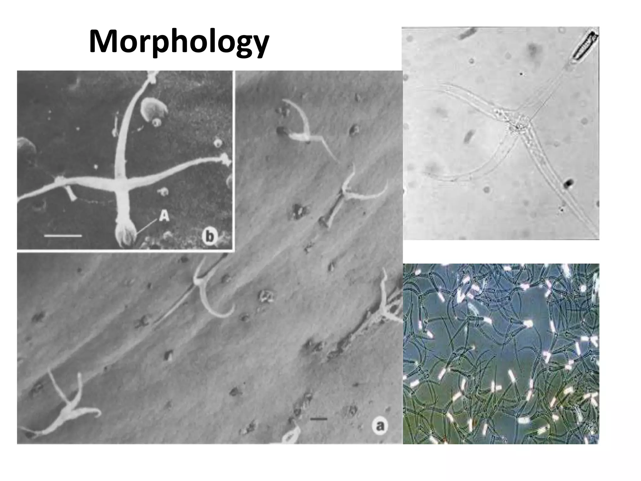 Myxozoan fish parasite life cycle | PPTX