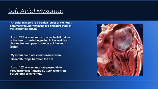 Myxoma powerpoint