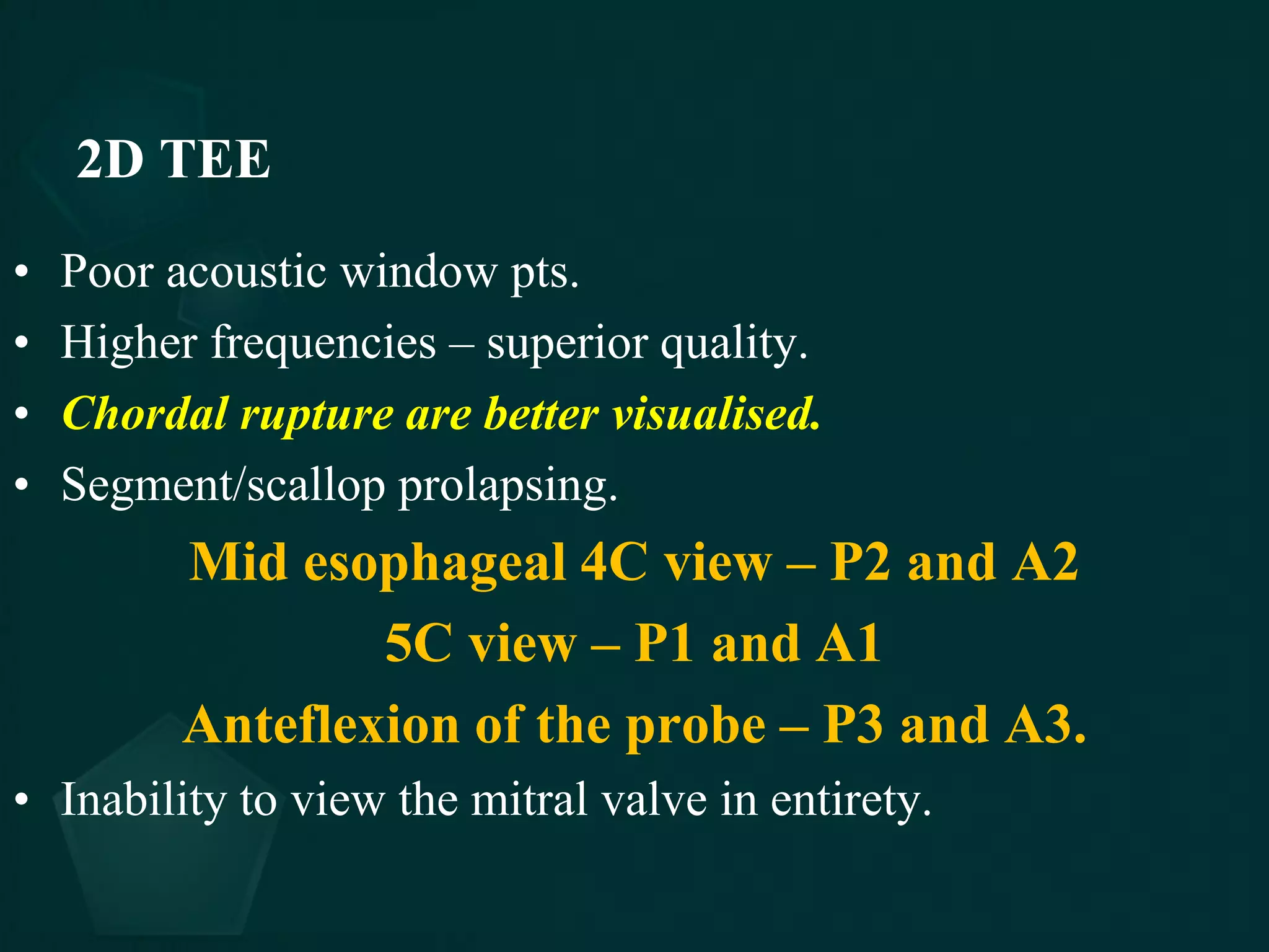 MVP Mitral Valve Prolapse - Echocardiographic Evaluation | PPTX