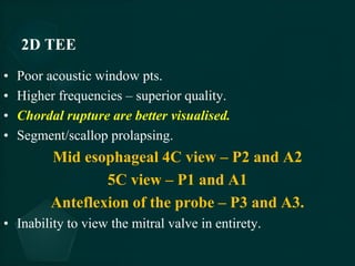 MVP Mitral Valve Prolapse - Echocardiographic Evaluation | PPTX