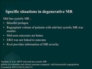 MVP Mitral Valve Prolapse - Echocardiographic Evaluation | PPTX