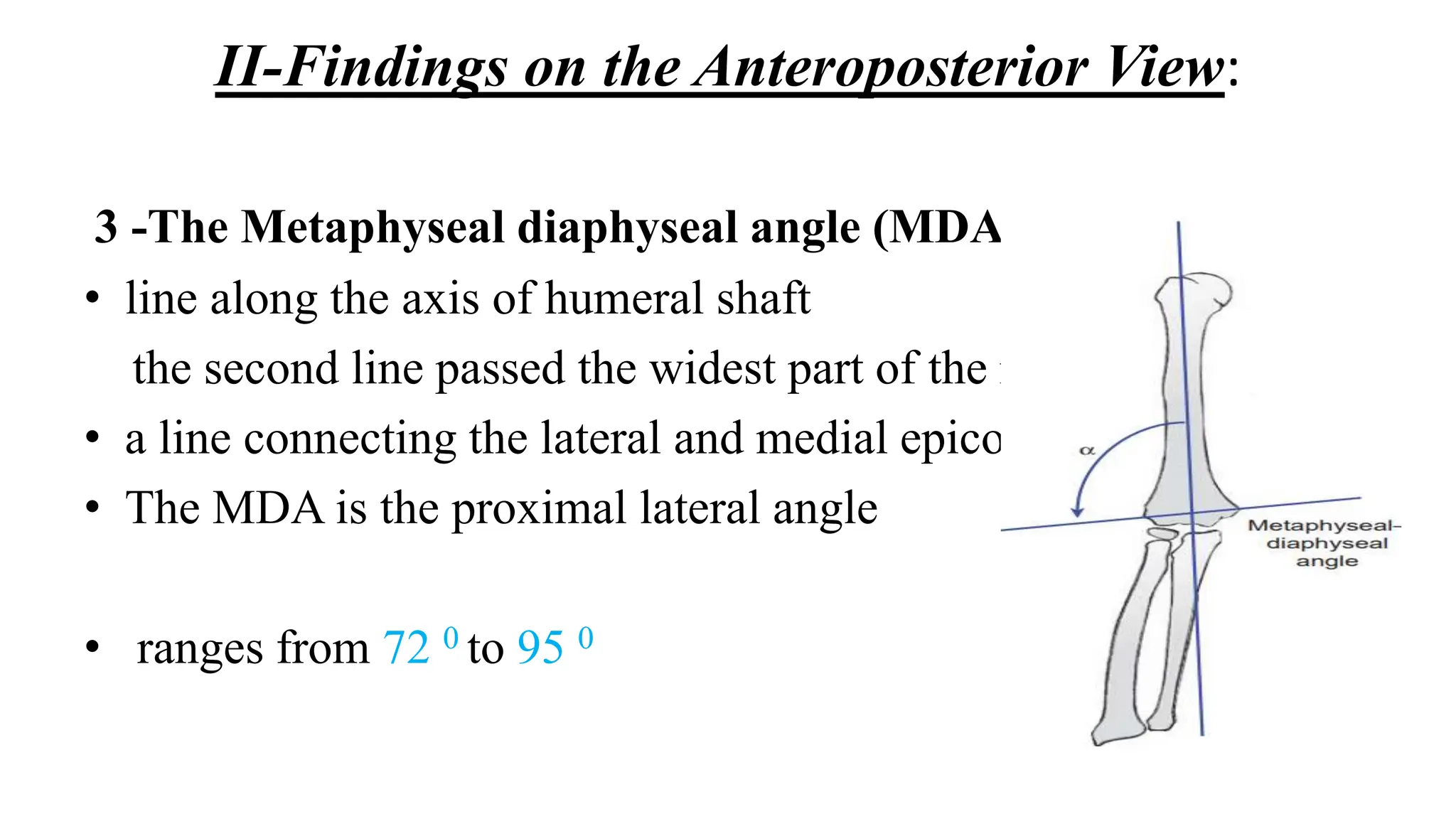 Pediatric Supracondylar humerus fracture .pptx