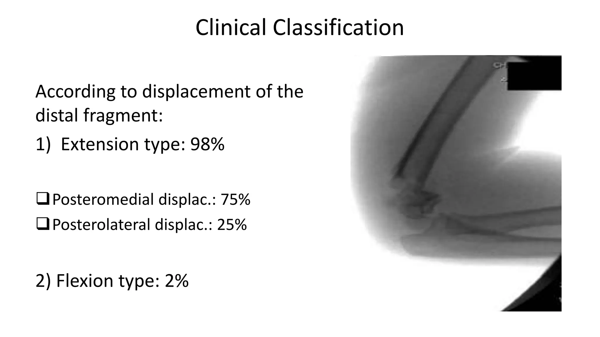Pediatric Supracondylar humerus fracture .pptx