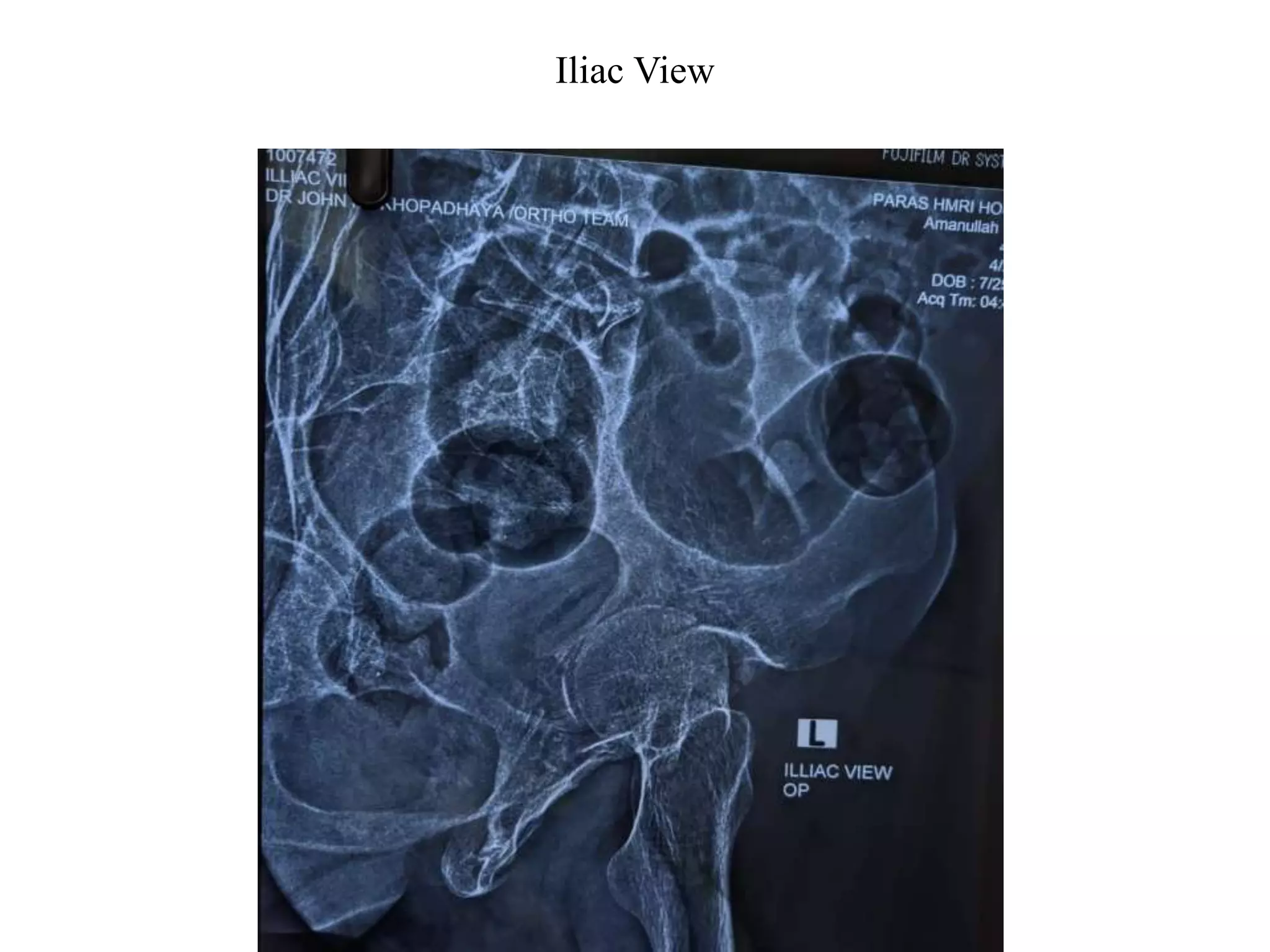 Pelvis radiographs | PPTX