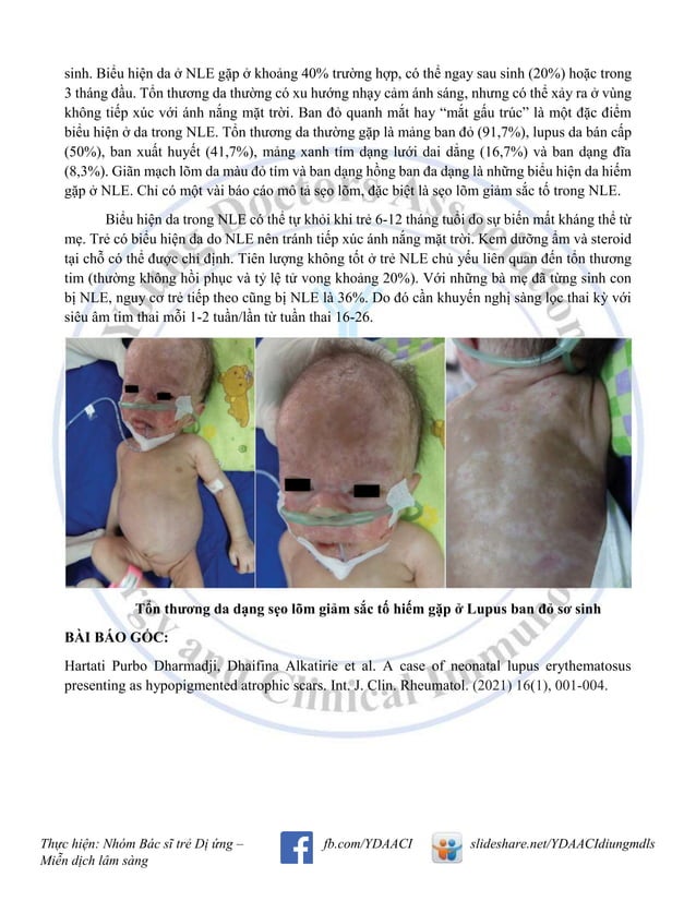N.HA. NEONATAL LUPUS.final.17.6.docx
