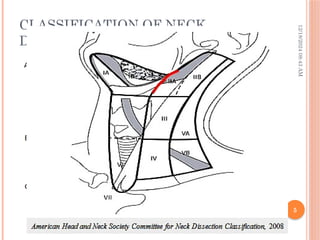 Neck dissection for head and neck squamous cell carcinoma | PPTX