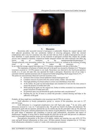 Pterygium Excision with Free Conjunctival Limbal Autograft | PDF