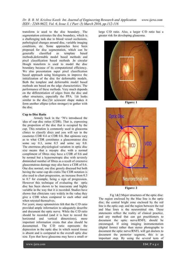 Glaucoma Screening Test By Segmentation Of Optical Discand Cup Segmentation Using Matlab