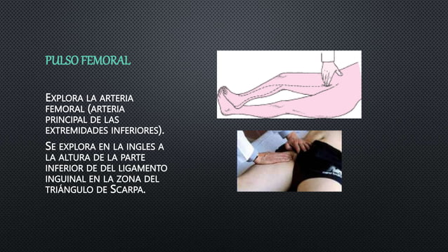 N° 4 Pulsos de la extremidad inferior.pptx | Foot Health | Diseases and ...
