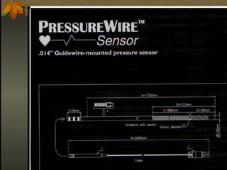 165 pressure wire | PPT | Heart and Cardiovascular Diseases | Diseases ...