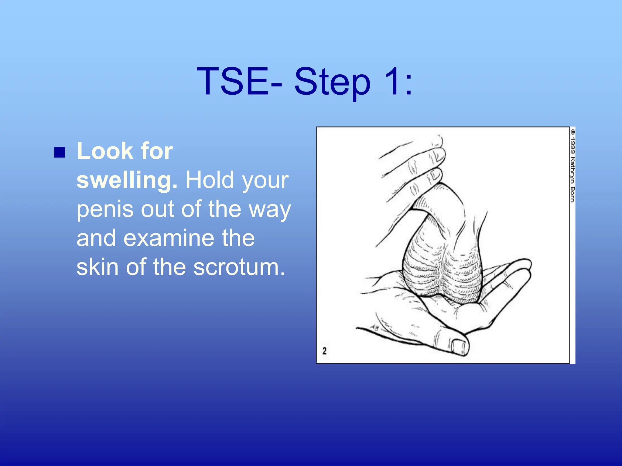N544- Physical Assessment of the Male GU System, Anus, Rectum and ...