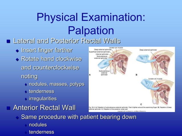 N544- Physical Assessment of the Male GU System, Anus, Rectum and ...