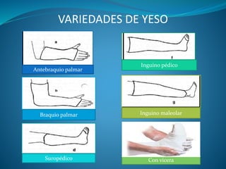 N7. Materiales de Enyesado | PPTX