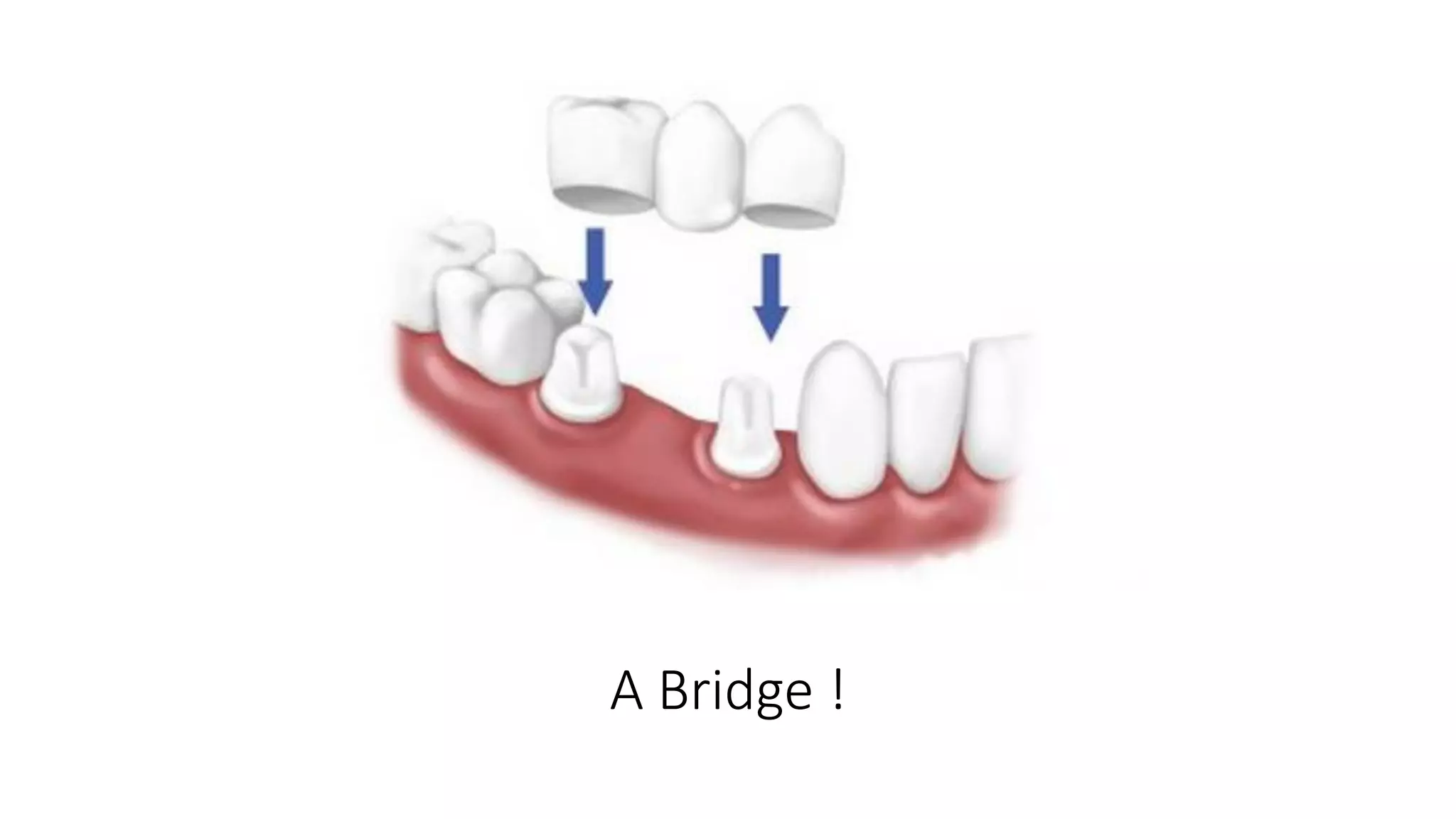 Structural Design of Bridges | PDF