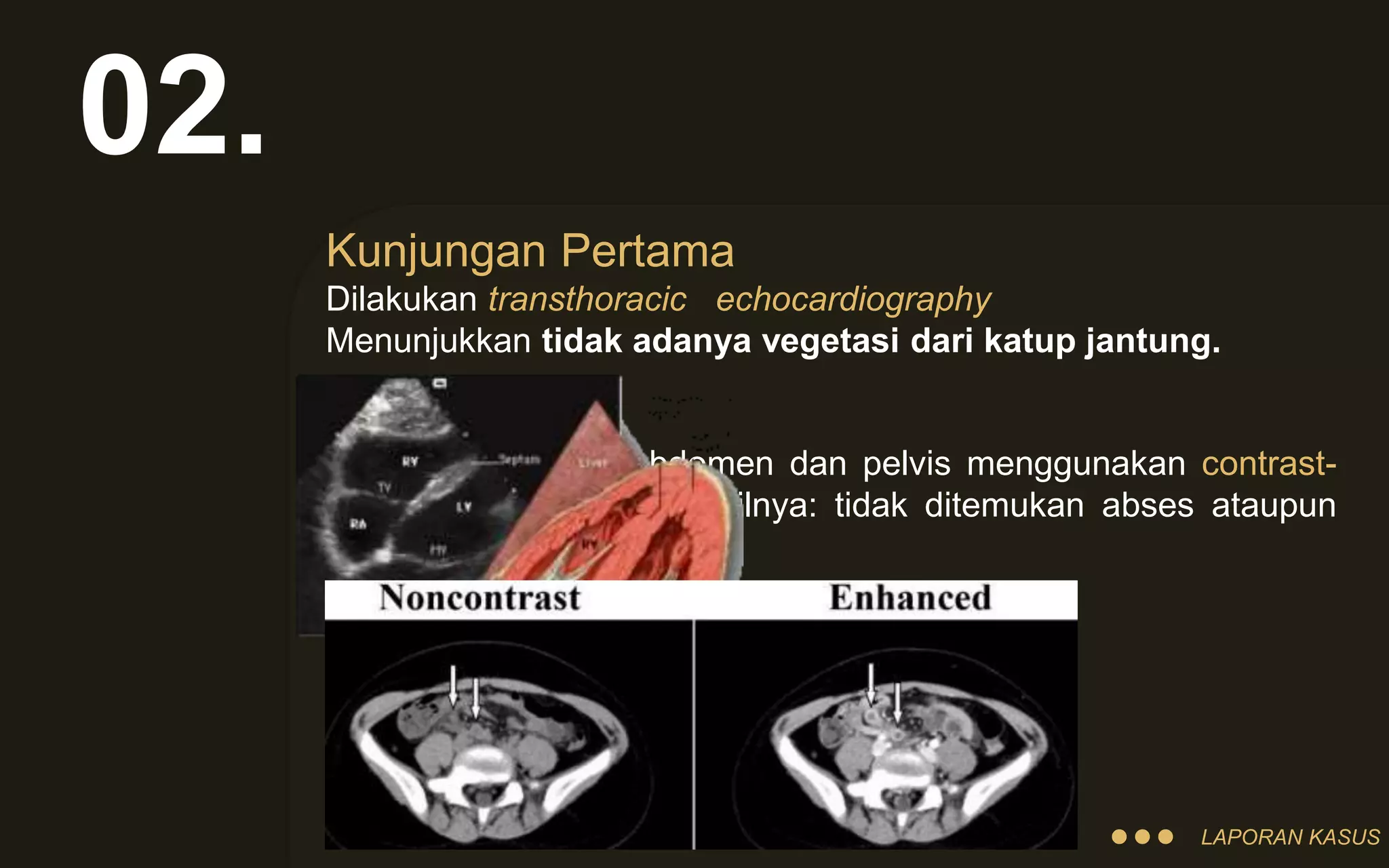 Septic Pulmonary Embolism Associated with Periodontal Disease: A case ...
