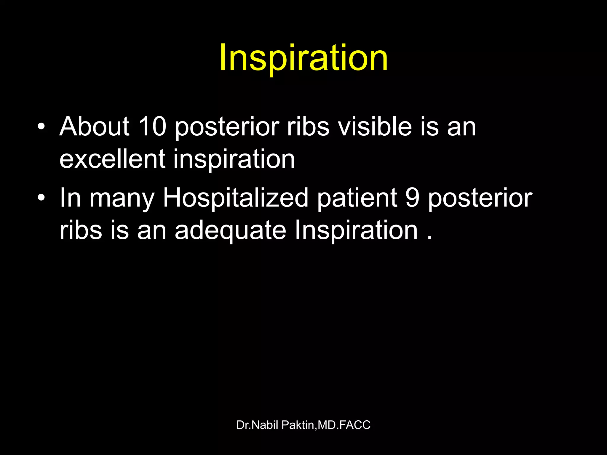 Chest-X ray , How to read a CXR | PPSX