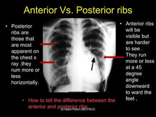 Chest-X ray , How to read a CXR | PPSX