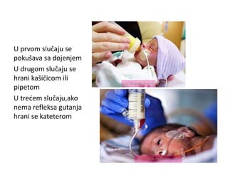 Nacin i tehnike hranjenja nedonosceta | PPTX