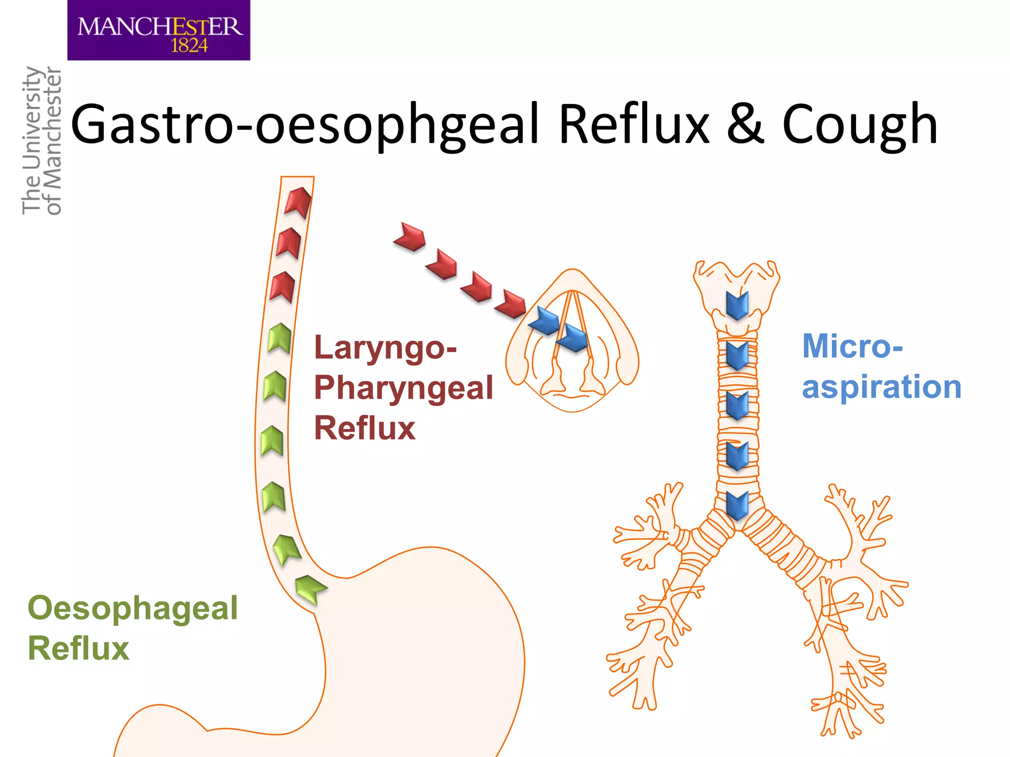 Chronic Cough: What it is and how to try to reduce its impact on your ...