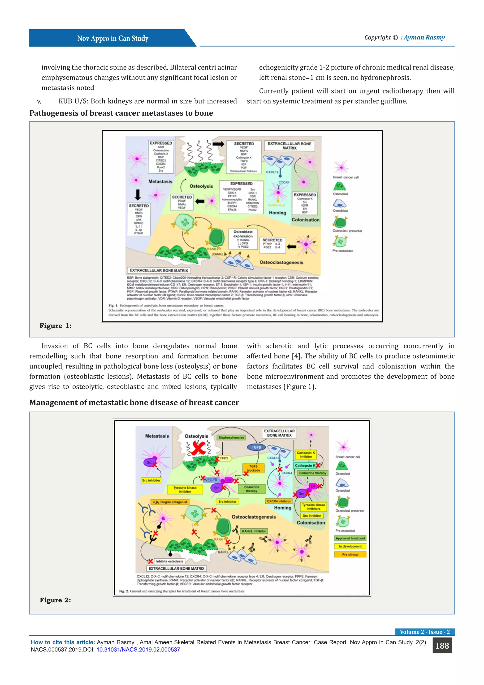 Skeletal Related Events in Metastasis Breast Cancer: Case Report ...