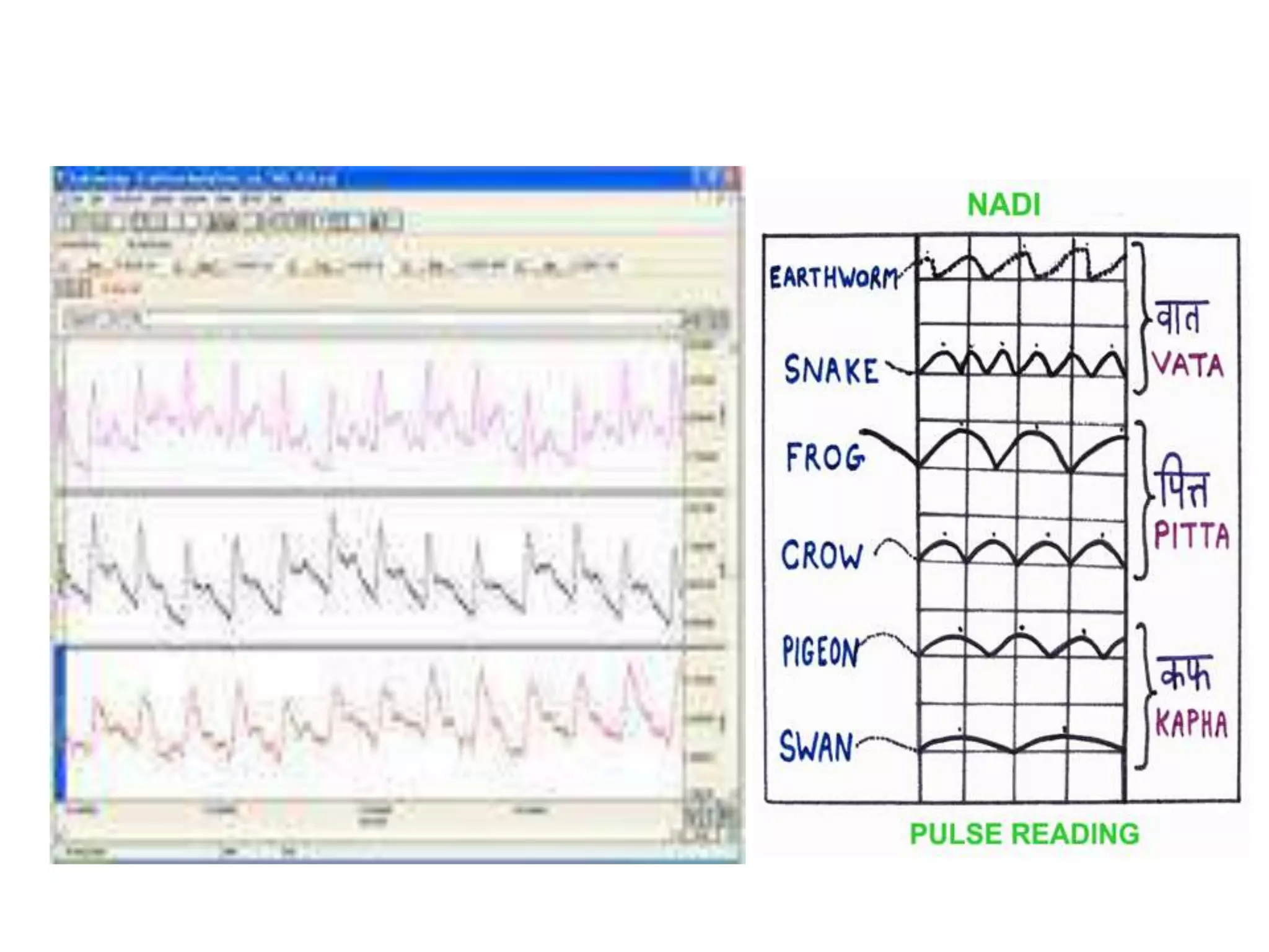 Nadi Pareeksha (Pulse Diagnosis) - An Authentic Scientific Approach | PPTX