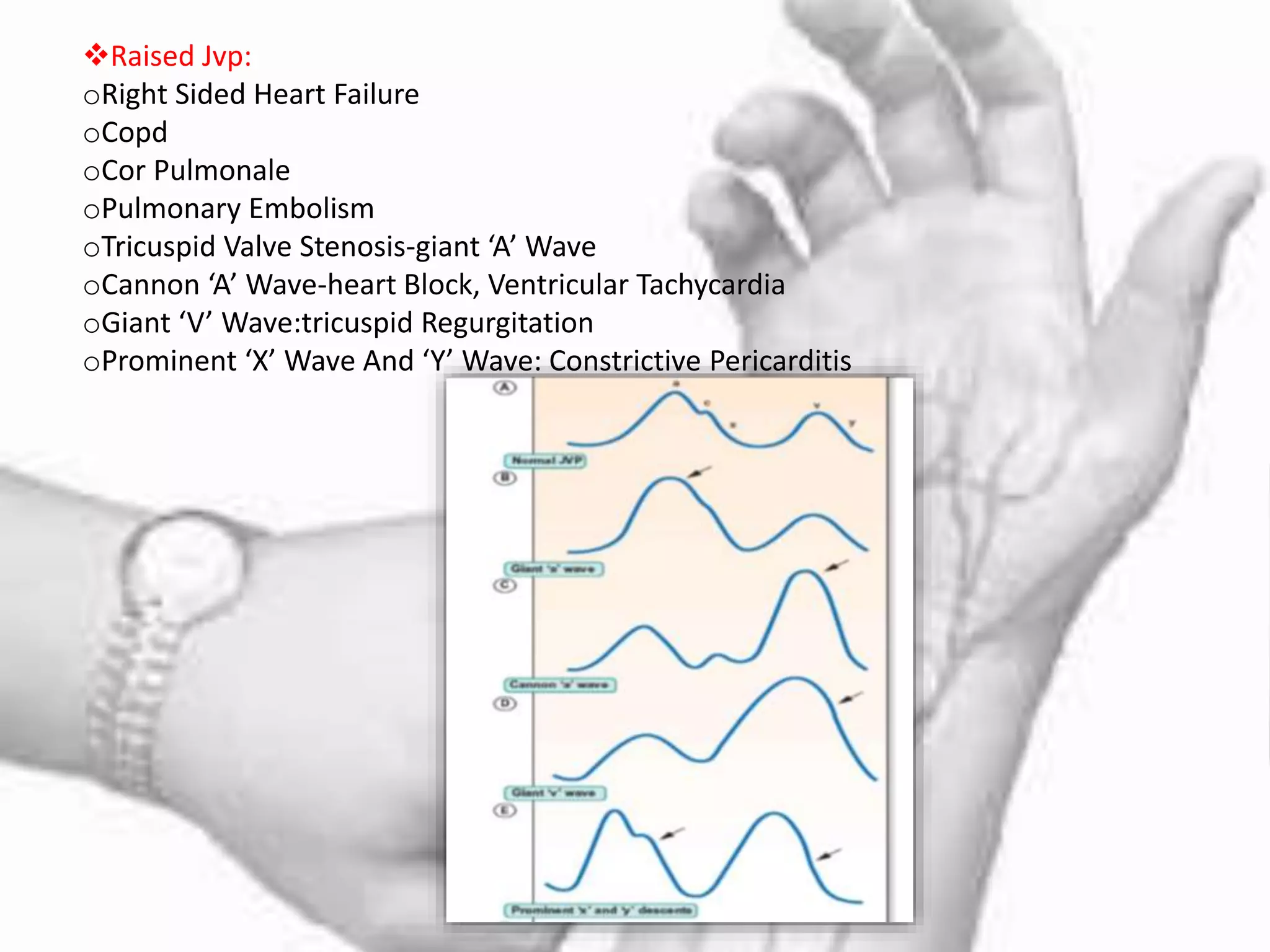 Nadi pareeksha- Ayurvedic pulse diagnosis | PPTX