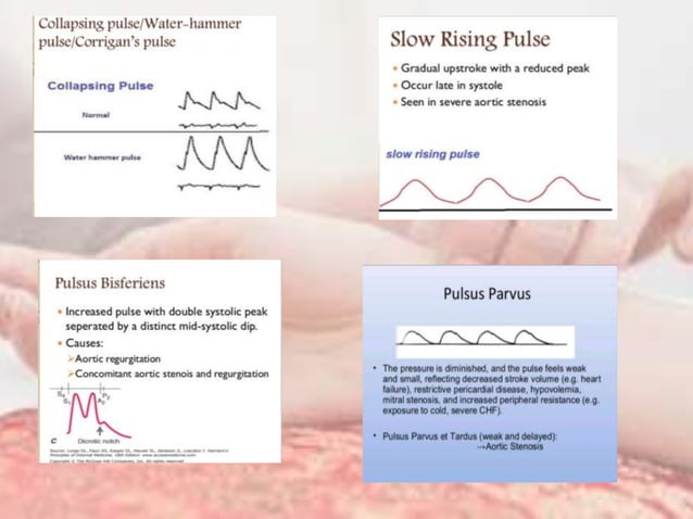 Nadi pareeksha- Ayurvedic pulse diagnosis | PPTX | Heart and ...