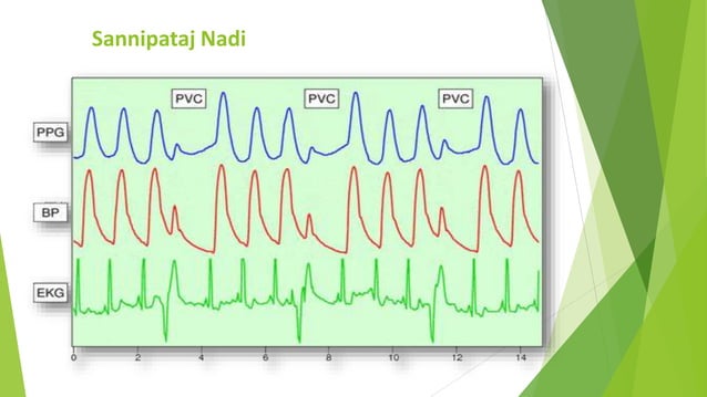 Nadi Pariksha - Ayurvedic Pulse Examination | PPT | Heart and ...
