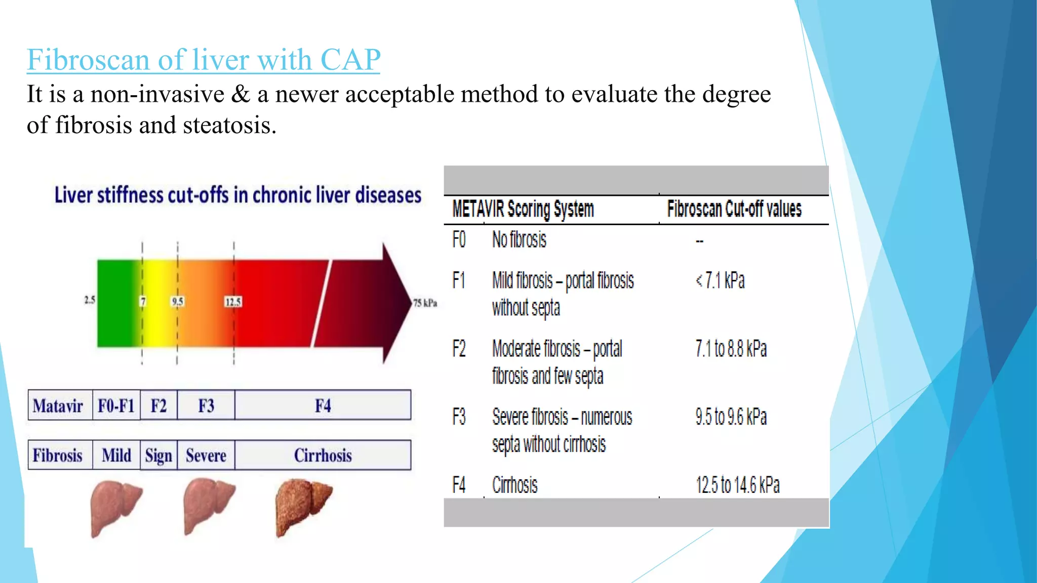 Non Alcoholic Fatty Liver Disease | PPTX