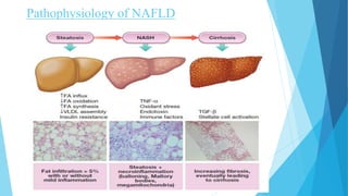 Non Alcoholic Fatty Liver Disease | PPTX