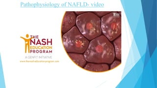 Non Alcoholic Fatty Liver Disease | PPTX