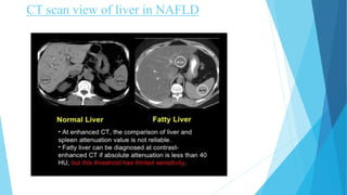 Non Alcoholic Fatty Liver Disease | PPTX
