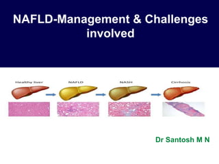 Nafld management -_challenges_involved | PPTX
