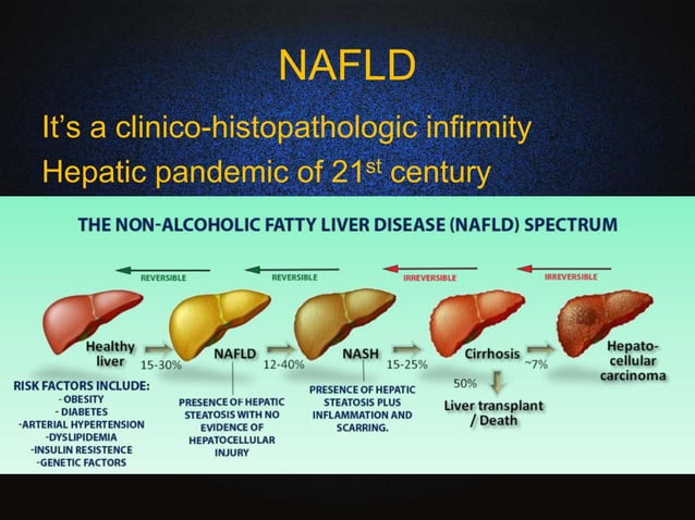 NAFLD-Metabolic Syndrome- THE LINK | PPTX | Endocrine and Metabolic ...