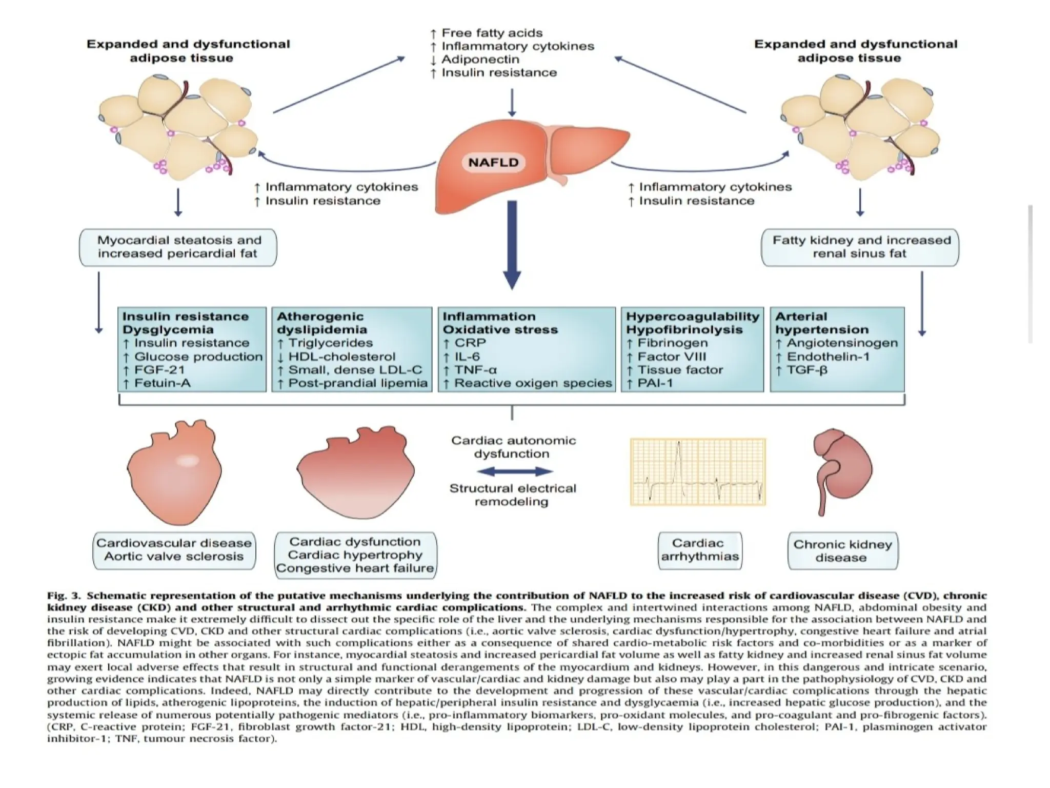 NAFLD A GREAT MASQUERADER A MULTI SYSTEM INVOLVEMENT - | PPTX