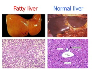 Evidence based management of Non Alcoholic fatty liver disease | PPTX