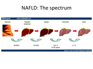 Evidence based management of Non Alcoholic fatty liver disease | PPTX