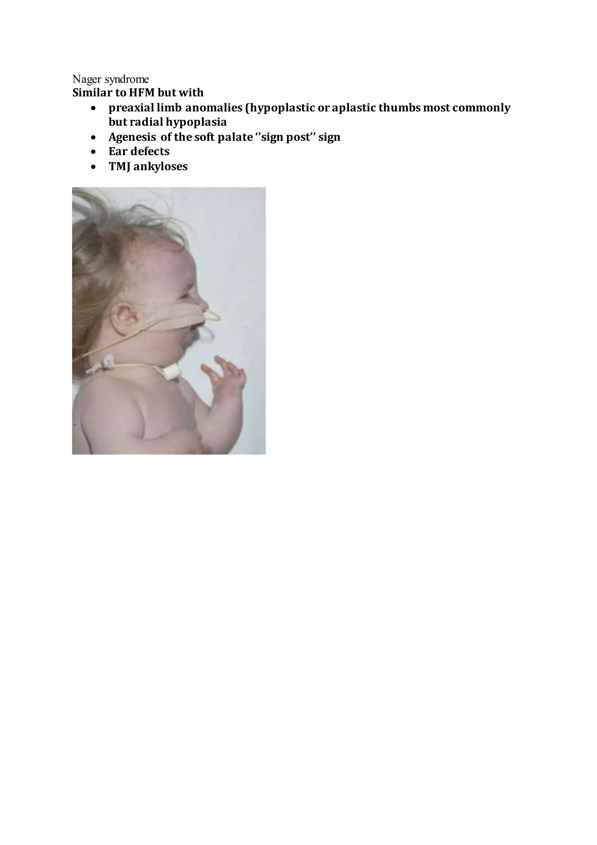 Nager syndrome for orthodontist by almuzian | DOCX